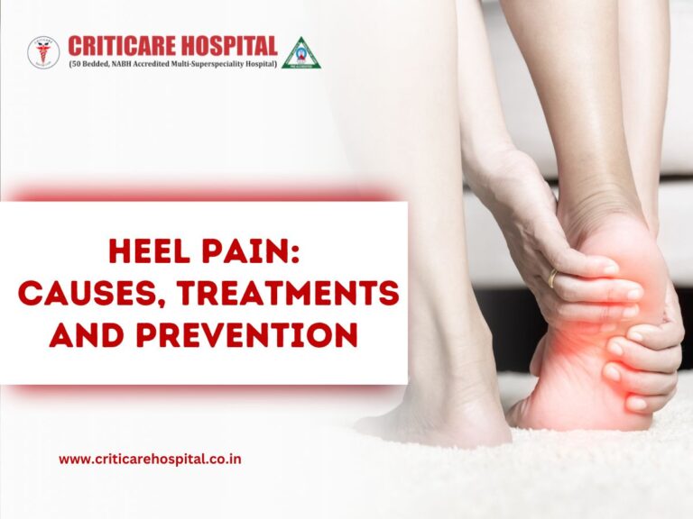 Heel Pain: Causes, Treatments and Prevention - CritiCare Hospital