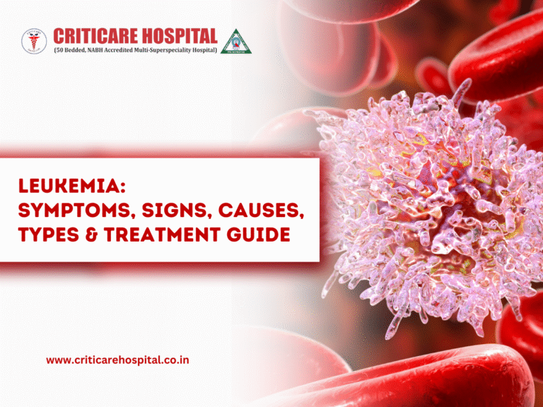 Leukaemia: Symptoms, Signs, Causes, Types & Treatment Guide - CritiCare ...